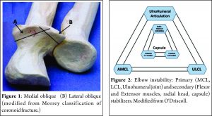 Terrible Triad – Is no More Terrible! – Journal of Clinical Orthopaedics